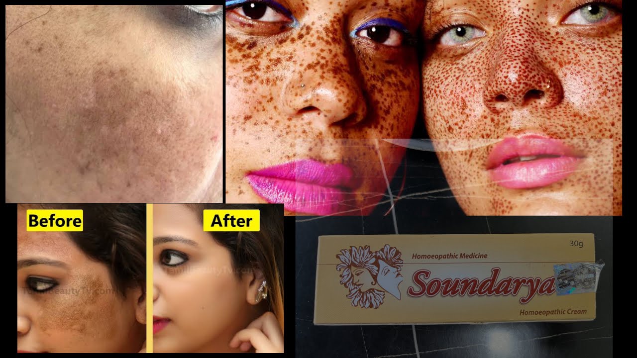 Best homeopathic cream for skin problems 👌|| Soundarya cream || - YouTube