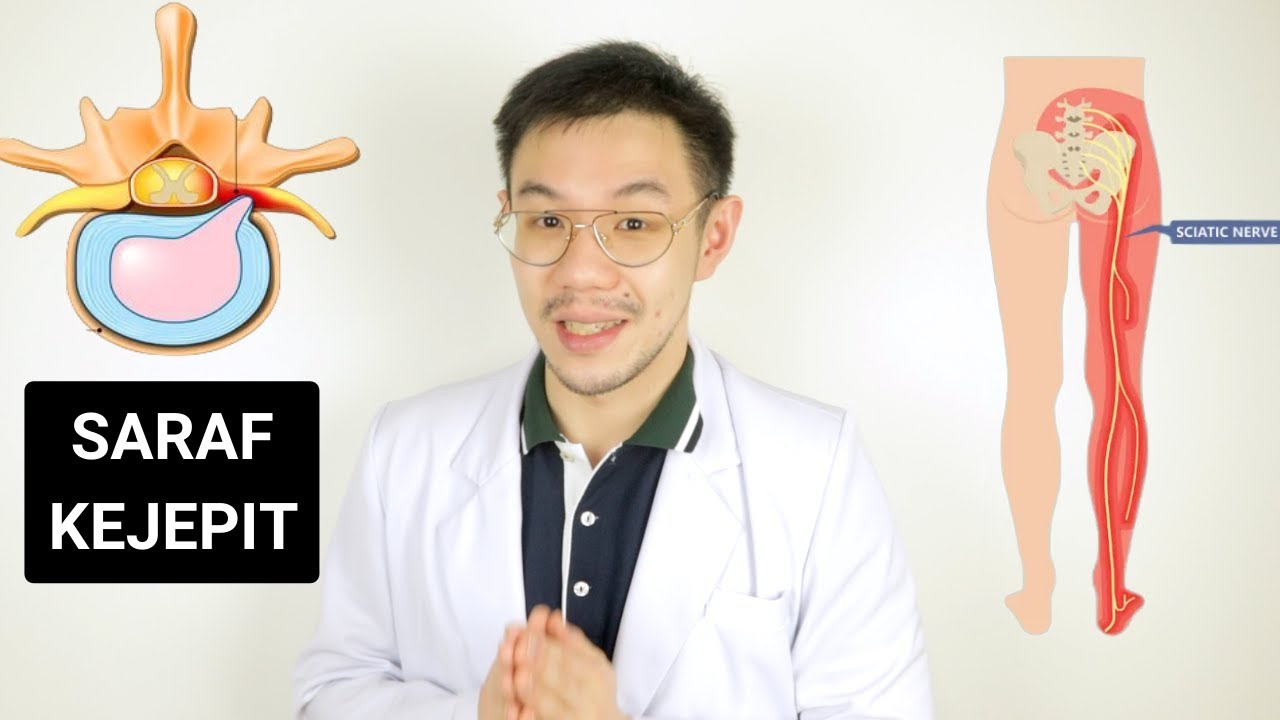 Rehabilitasi Saraf Kejepit / HNP - YouTube