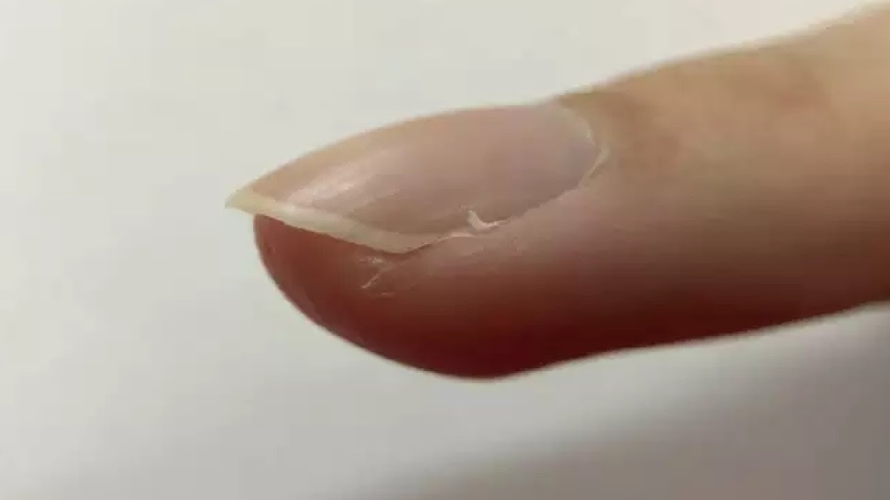 how to get rid of a hangnail without nail clippers - YouTube
