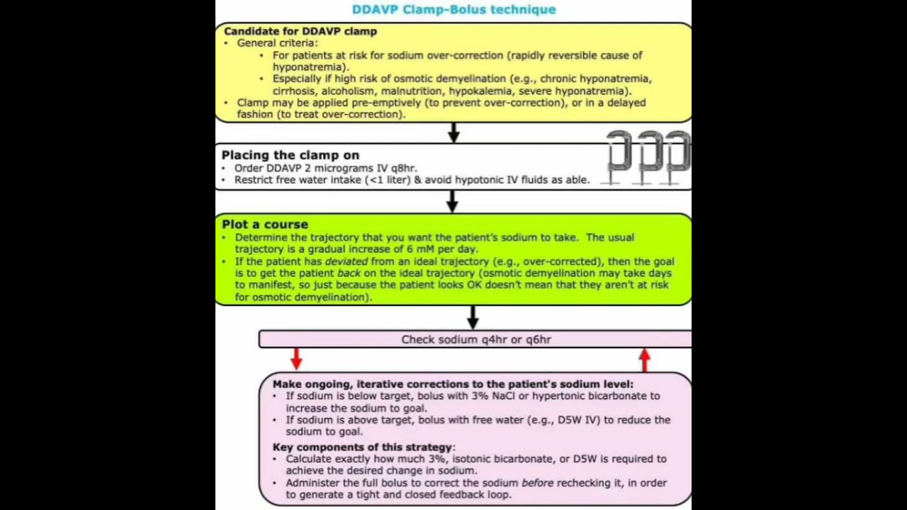 #DDAVP Clamp-Bolus technique for severe hyponatremia - YouTube