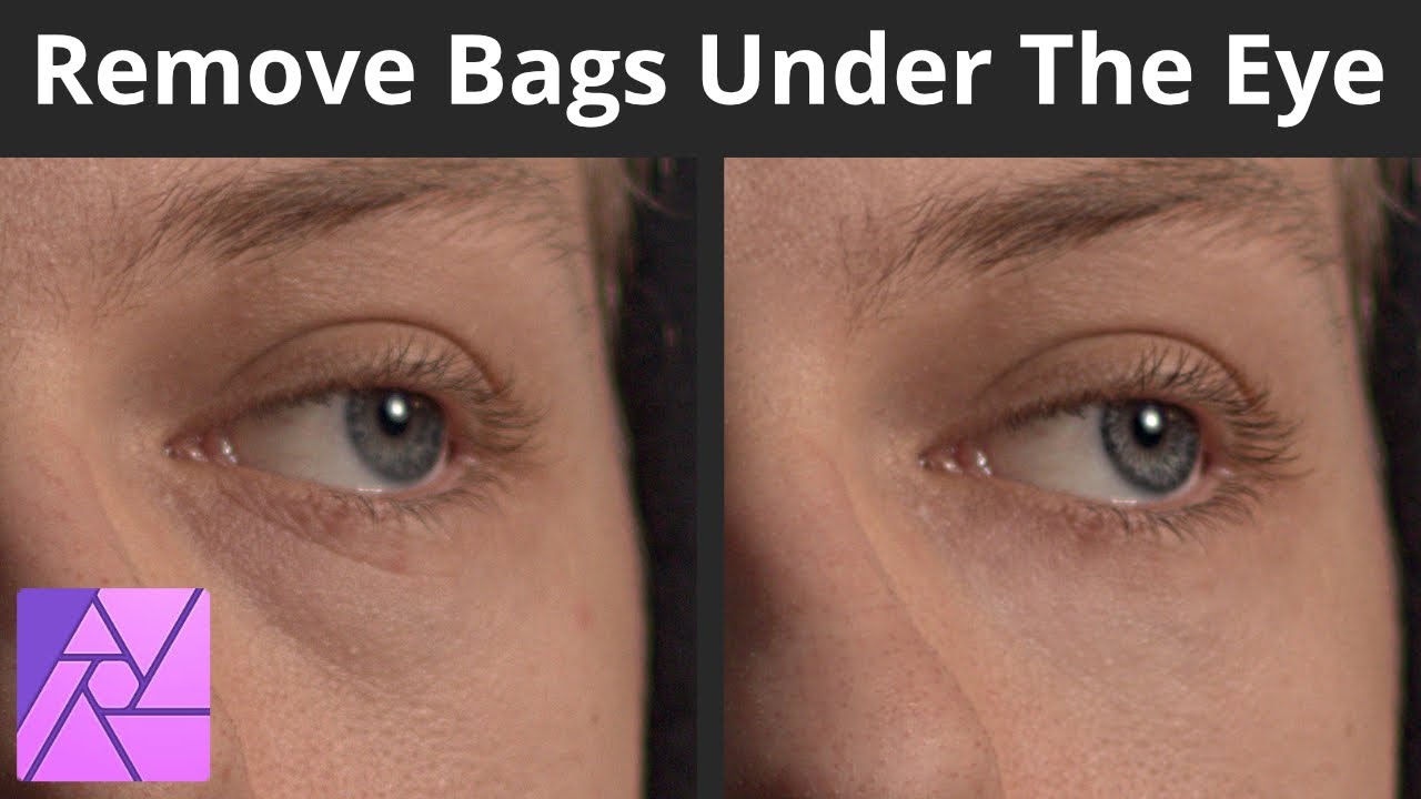 How To Remove Bags Under The Eye Affinity Photo Tutorial YouTube how-to-remove-bags-under-the-eye-affinity-photo-tutorial-youtube