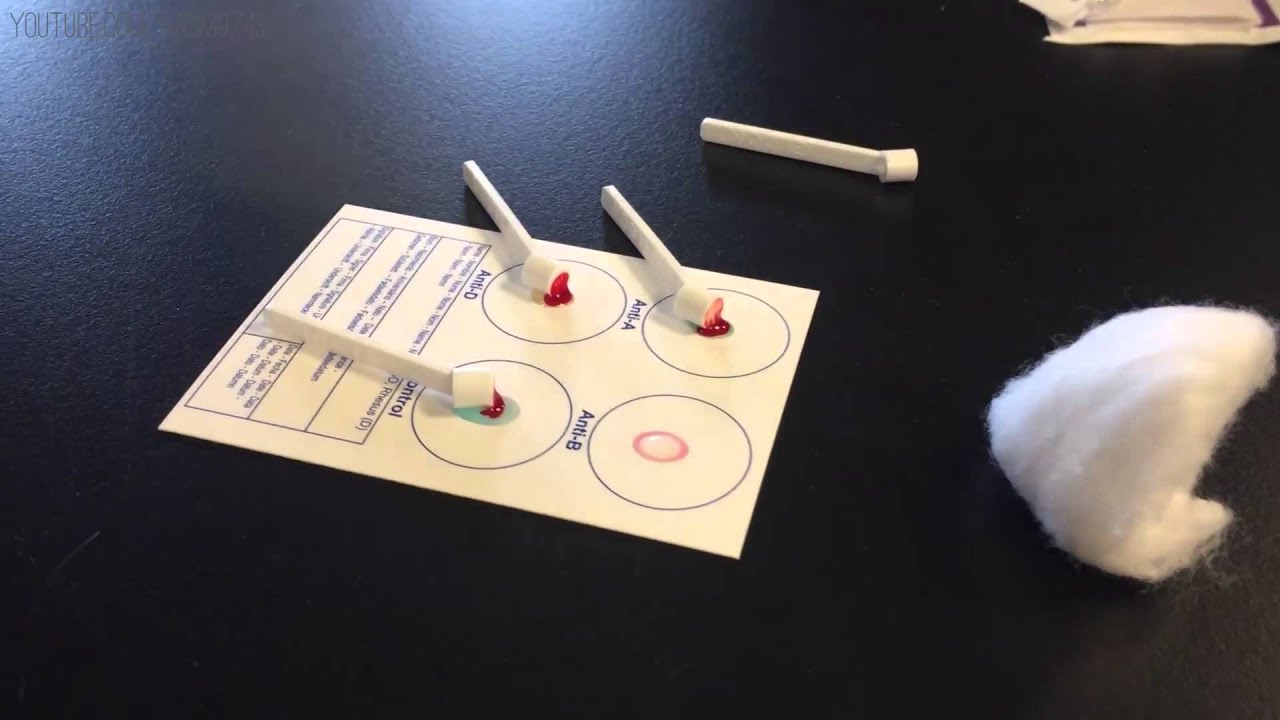 Instuktion i at bruge eldonkort (Eldoncard) - YouTube