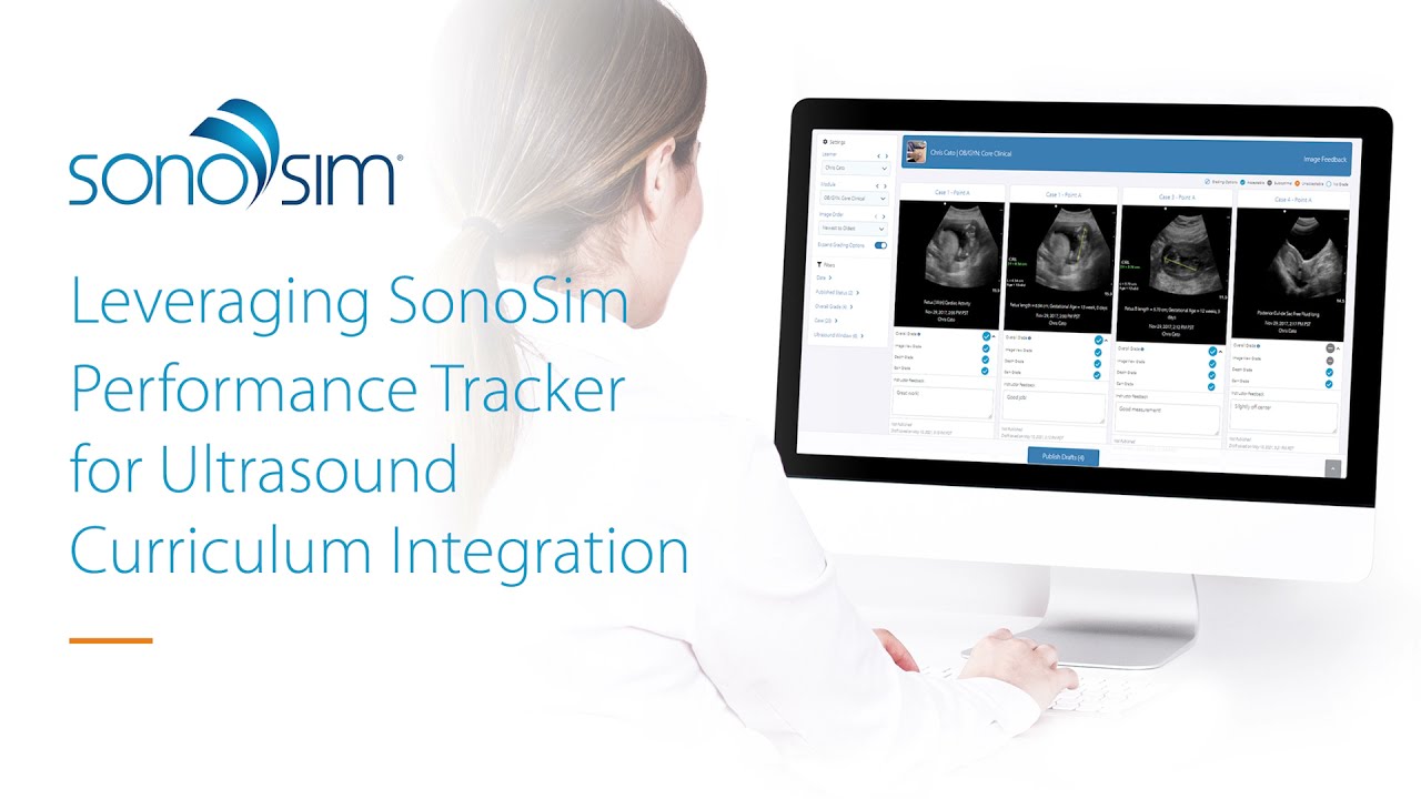 Leveraging SonoSim® Performance Tracker for Ultrasound Curriculum ...