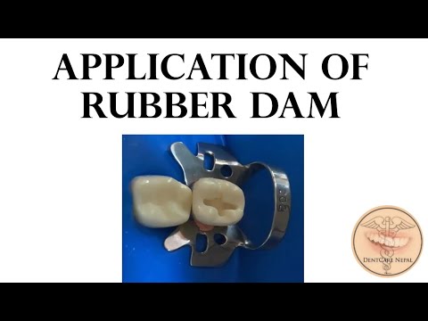 Application of Dental dam - Use of Rubber Dam in Dentistry - YouTube