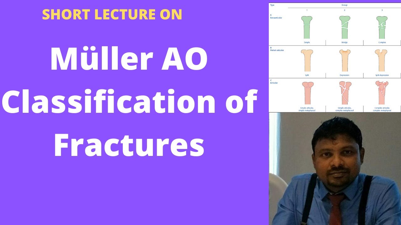 Müller AO Classification of fractures - YouTube