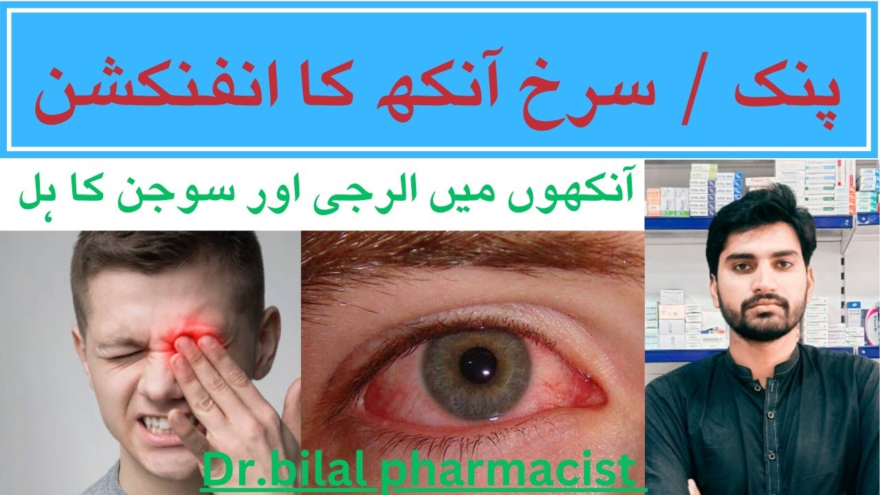Moxifloxacine eye drops /Moxigan eye drops uses in urdu/side effects ...