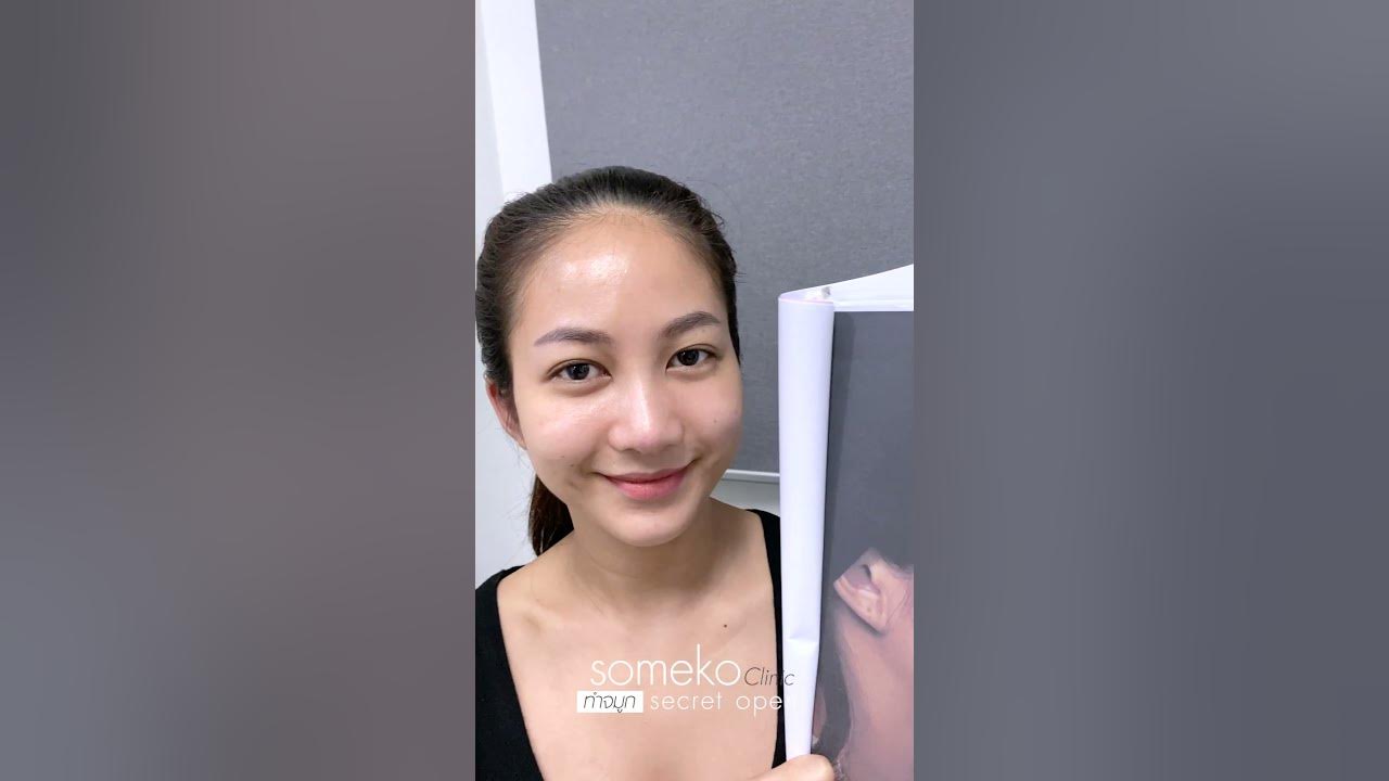 ปัญหาจมูกใหญ่ เนื้อจมูกเยอะ #เสริมจมูก #someko - YouTube