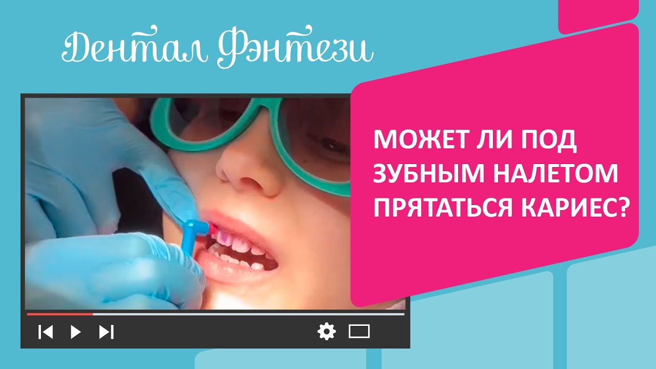 🧏♀️ Может ли под зубным налетом прятаться кариес Youtube