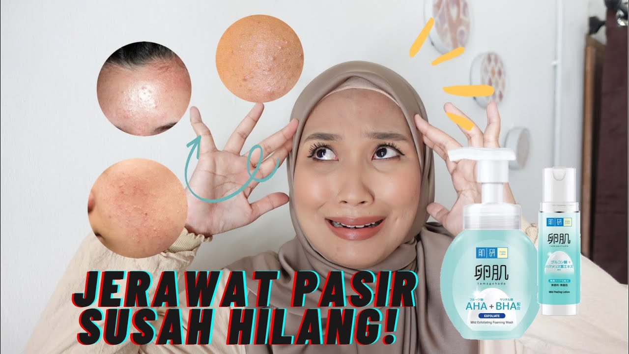 JERAWAT PASIR sampai KULIT NAMPAK MENGGERUTU 🤢 | HADA LABO - YouTube