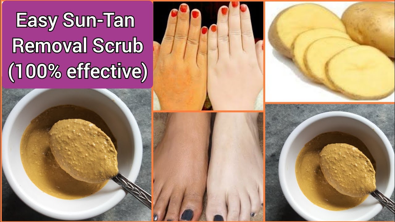 How to remove Sun-Tan Instantly From Face & Body || How To Remove Body ...