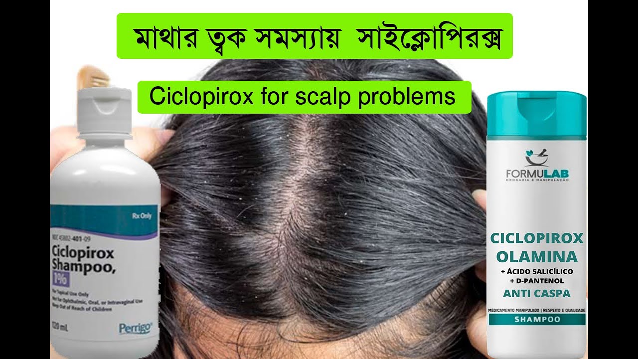 Ciclopirox shampoo review | মাথার ত্বক সমস্যায় সাইক্লোপিরক্স - YouTube