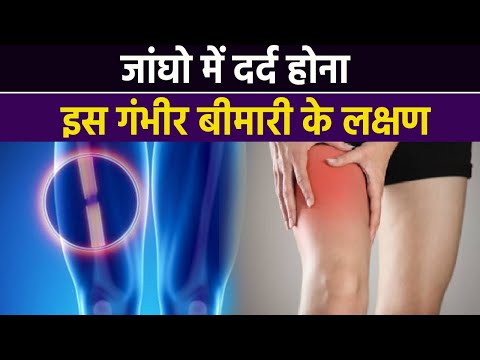 Thigh Pain होना Sciatica के Symptoms, क्या है कारण और उपाय |Boldsky