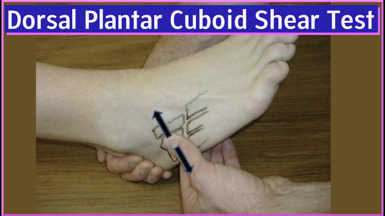 Dorsal Plantar Cuboid Shear Test | Cuboid Syndrome - YouTube