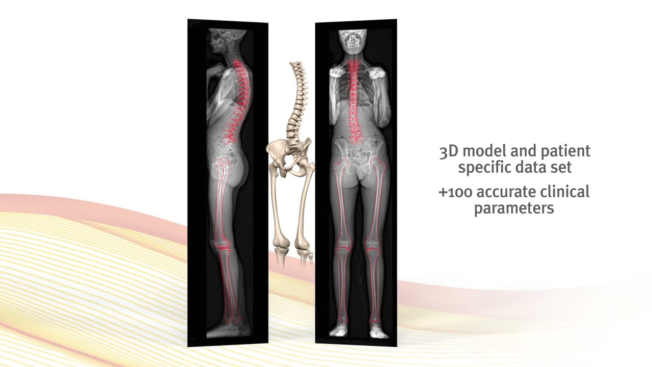 EOS How Does It Work - YouTube