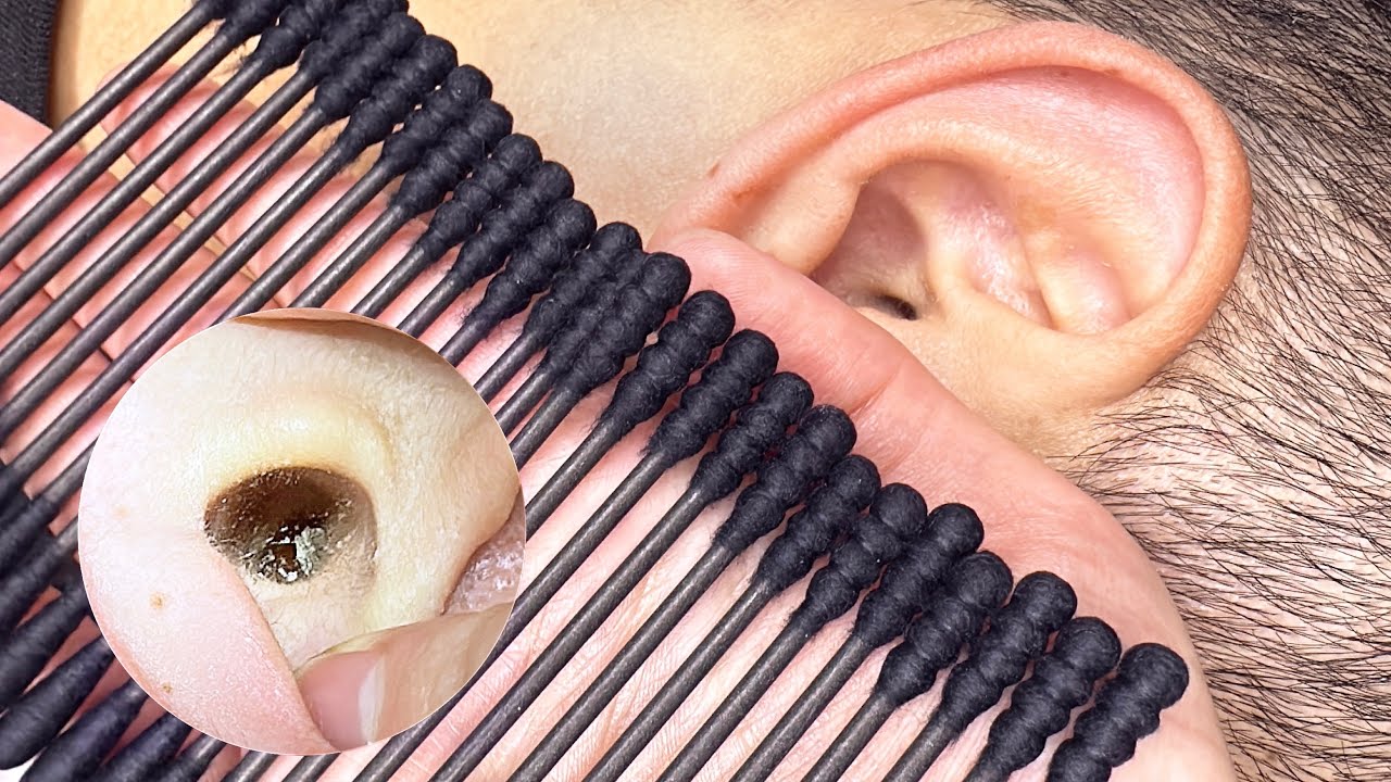 ASMR 벅벅 긁어주는🚫 진짜 시원한 귀청소 ear cleaning no talking #耳掃除 - YouTube