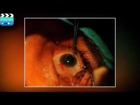 İnsan Vücudunda Bulunan Hayvanlar