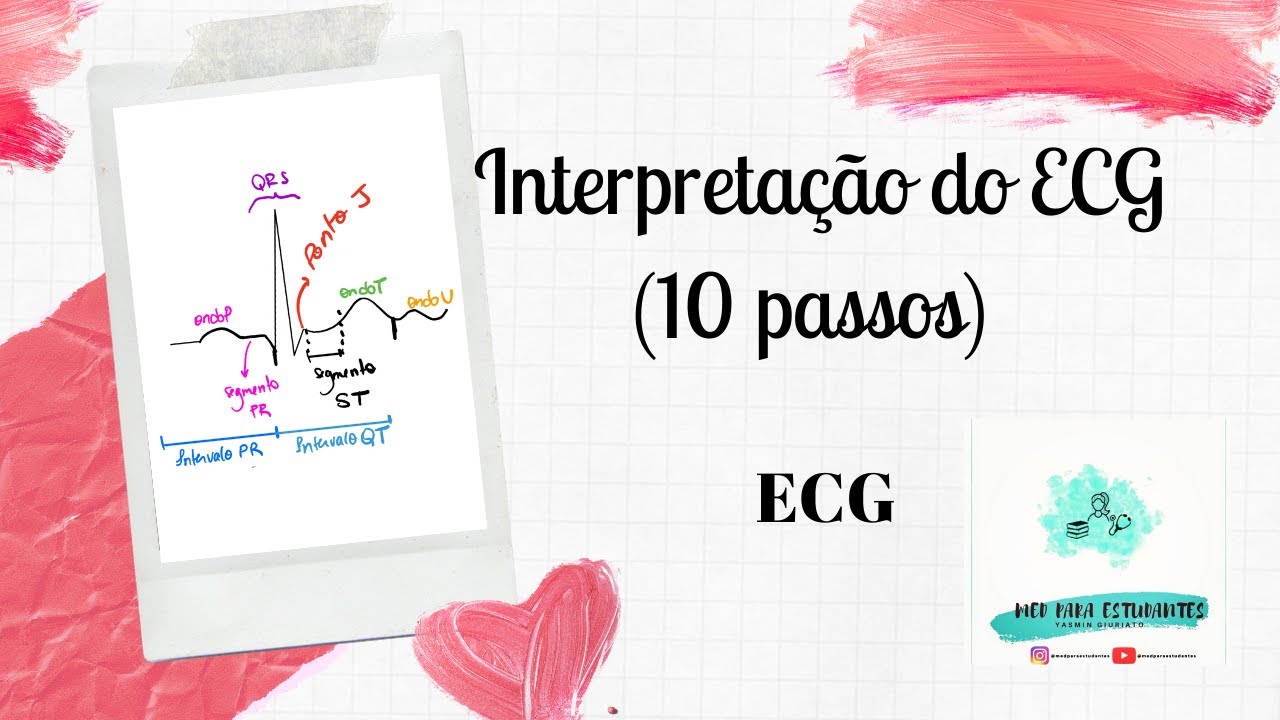 ECG - O papel do eletrocardiograma e sua interpretação (10 passos ...