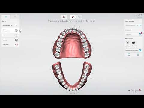 3Shape - Lab custom order form creation for TRIOS - YouTube