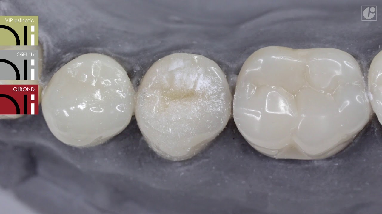 VIP esthetic & VIP Posterior - OLIDENT [PL] - YouTube