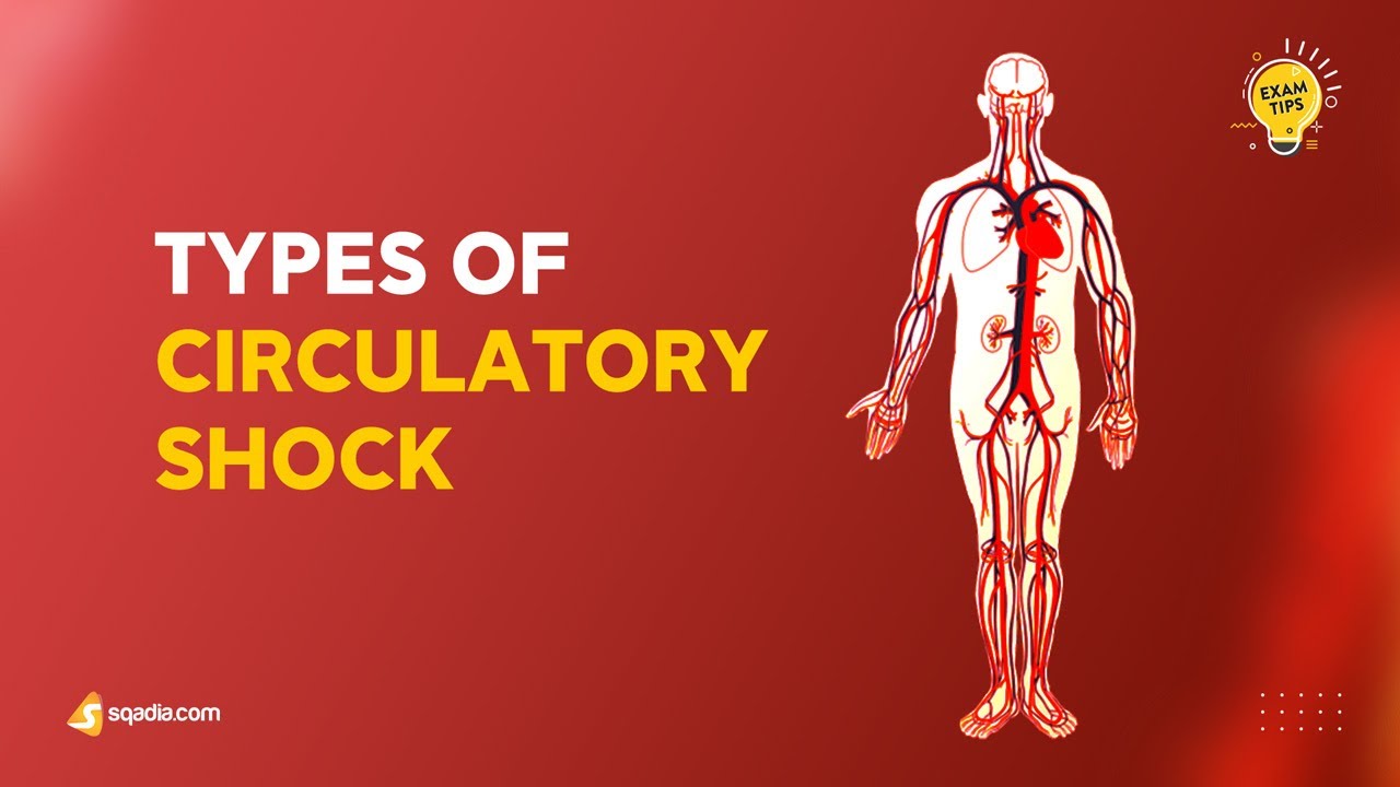 Types of Circulatory Shock | Emergency Medicine Lecture | V-Learning ...