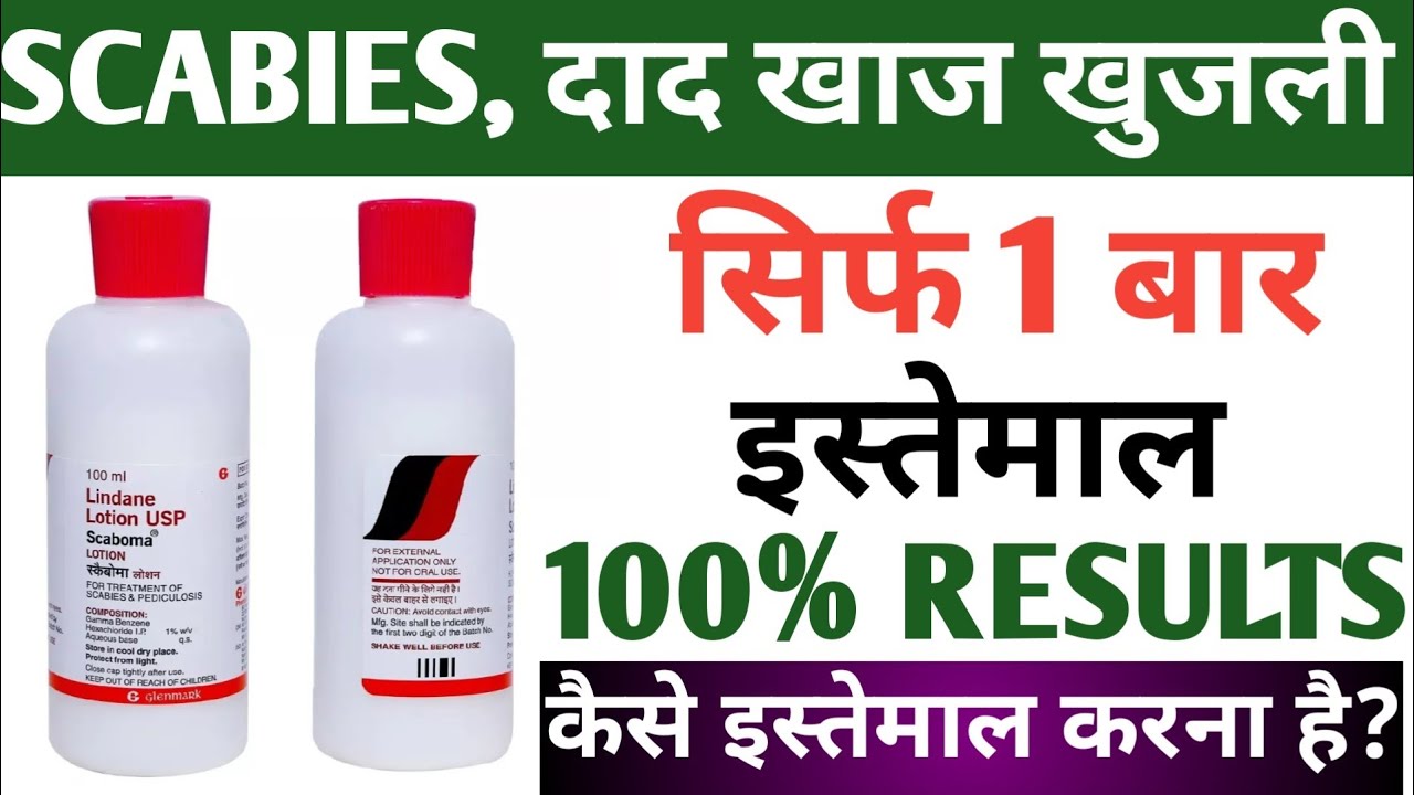 Scaboma Lotion | SCABIES, दाद खाज खुजली मिटाने का आसान तरीका | How To ...