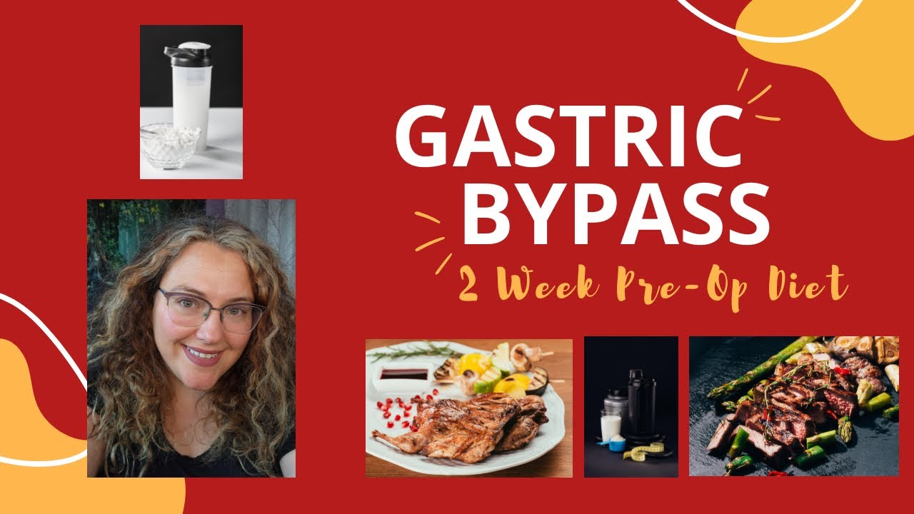 LILY'S GASTRIC BYPASS || 2 Weeks Pre-Op Diet || Surgery 11.29.22 - YouTube