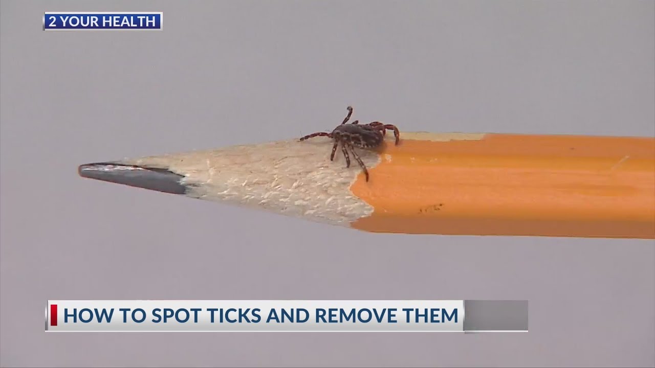 2 Your Health: How to spot ticks and remove them - YouTube