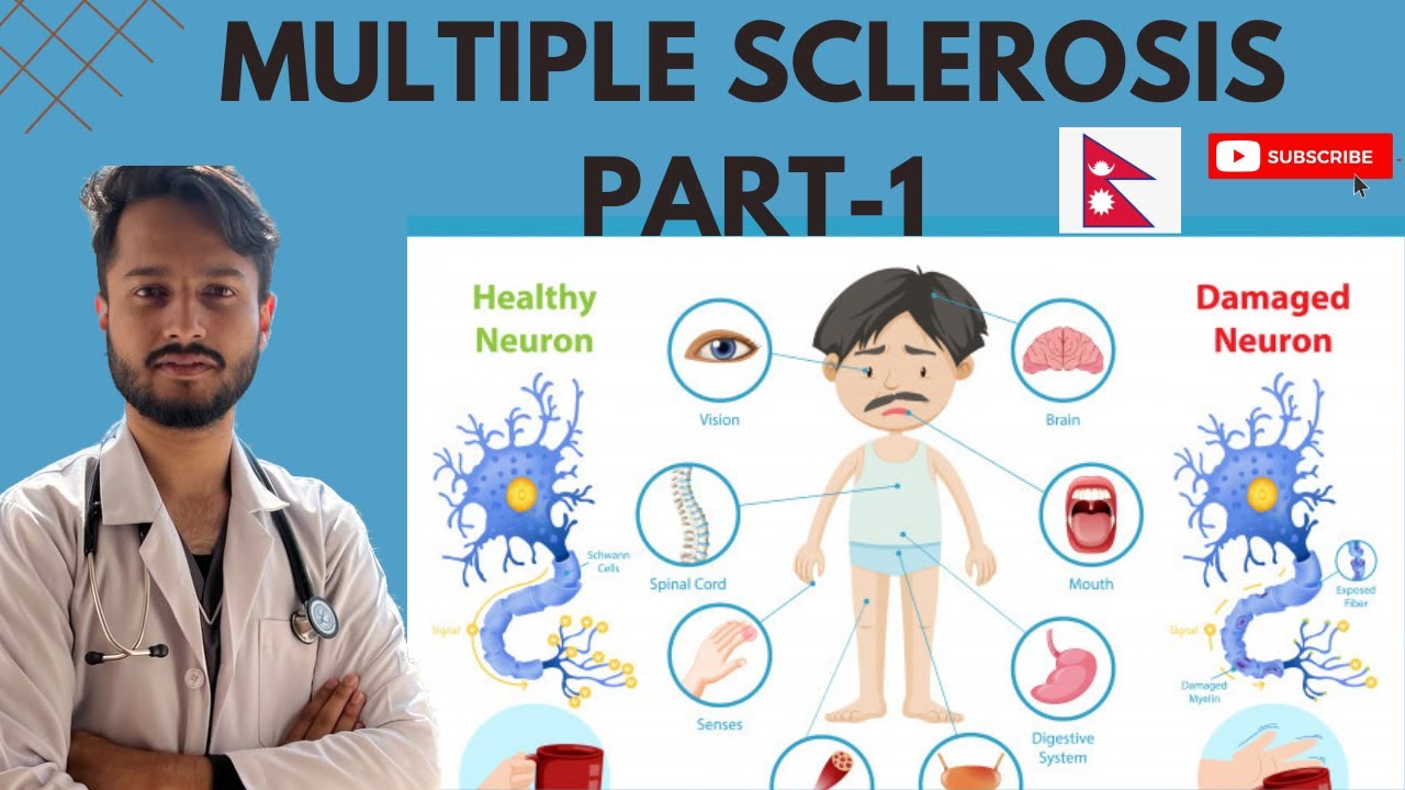 MULTIPLE SCLEROSIS PART-1 | CNS MEDICINE| NEPAL MEDICAL COLLEGE JORPATI ...