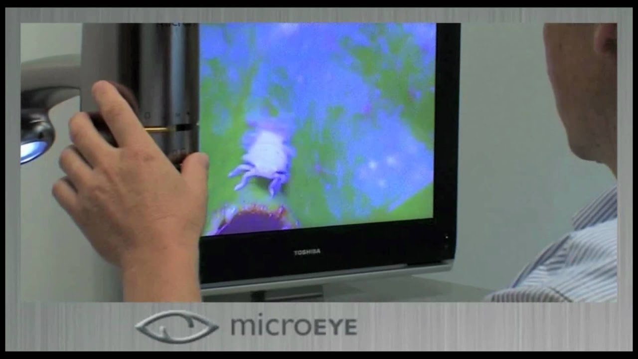 Introducing microEYE DISCOVERY - the unique video microscope - YouTube