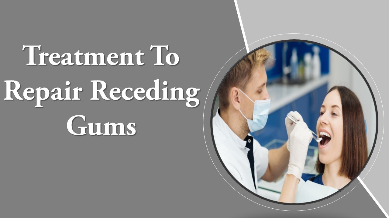 Repair Gums - Treatment To Repair Receding Gums - YouTube