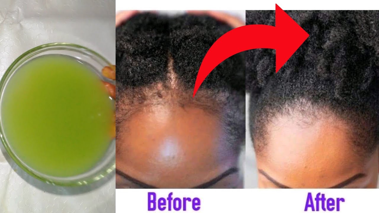 Try this, you will be shocked, Edge Regrowth. get back your Edges now ...