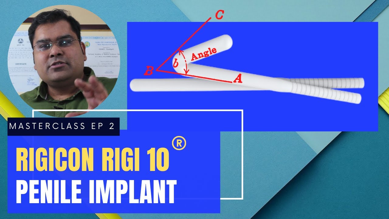 Bending penile implant : Rigi10 Rigicon Masterclass Ep2 - YouTube
