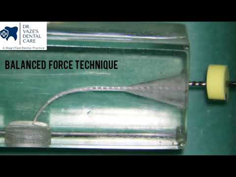 Various Hand motions in Endodontics part 4 - Balanced Force Technique ...