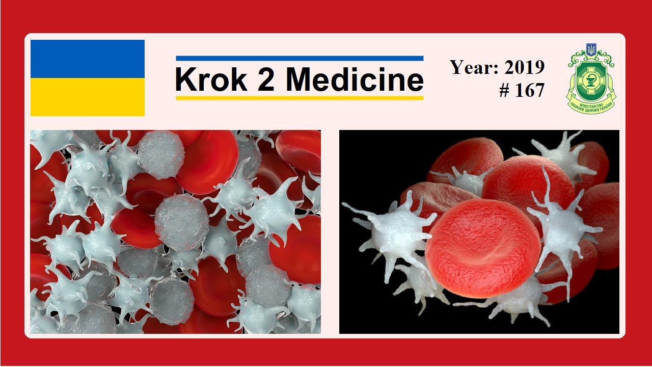 [ Krok 2 Medicine ] Year: 2019 - 167 (Ministry of Public Health of ...