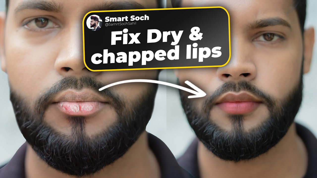 How to Fix Dry & Chapped Lips😢 - YouTube