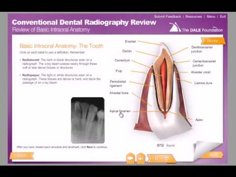 Conventional Dental Radiography Review - YouTube