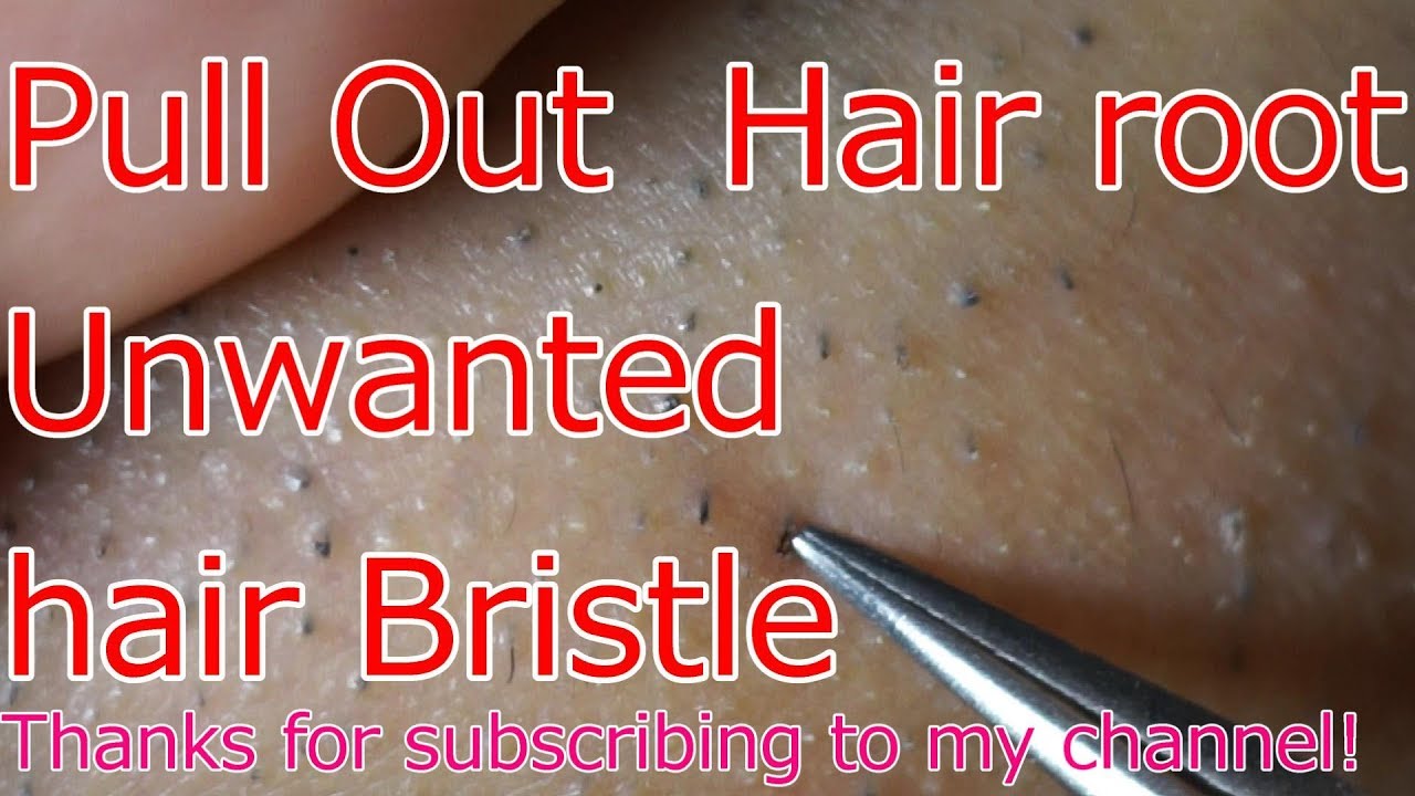 Pull Out Unwanted hair Bristle use tweezers Hair root【Hair remove ...