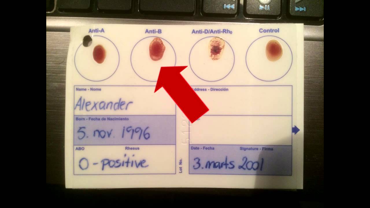 Mit Eldonkort - Screencast - YouTube