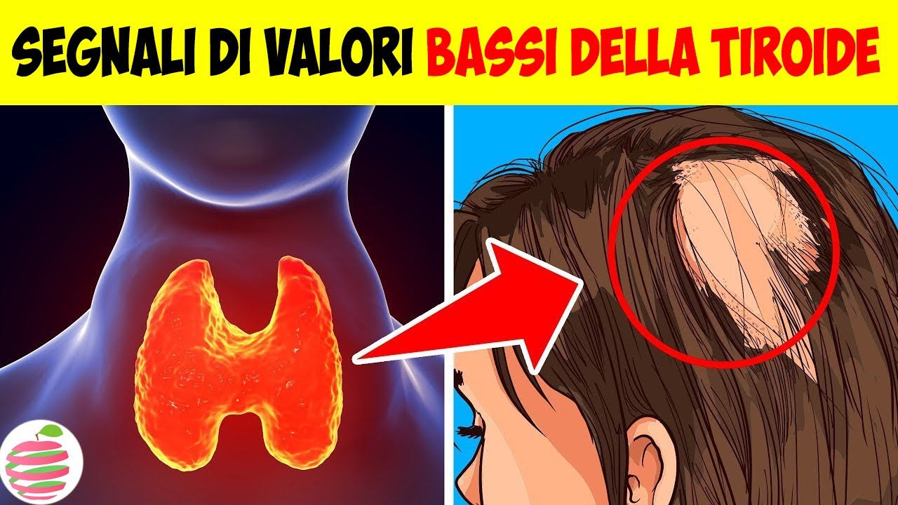 Se Mostri i Sintomi di Questi 10 Segnali Di Pericolo, Potresti Avere ...
