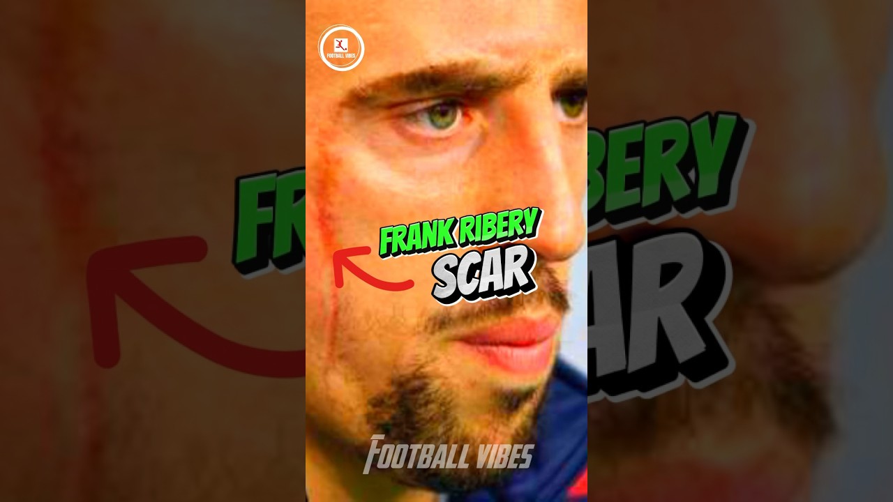 “Revealing The Reason Behind Frank Ribery Scar”😱 #football #soccer # ...