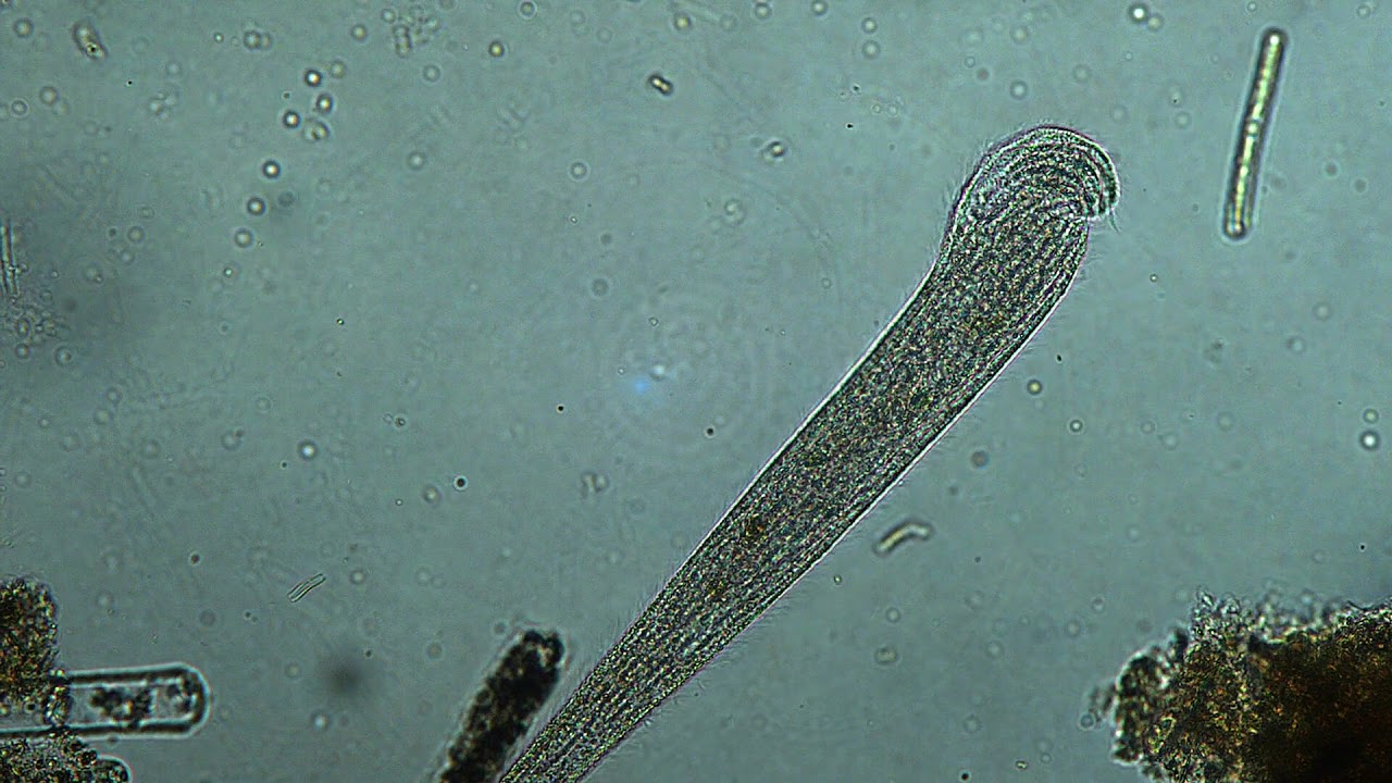 Spirostomum Under Microscope