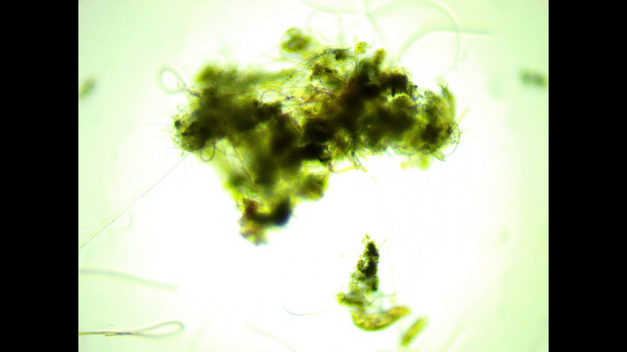 white stringy bacteria 10 - YouTube