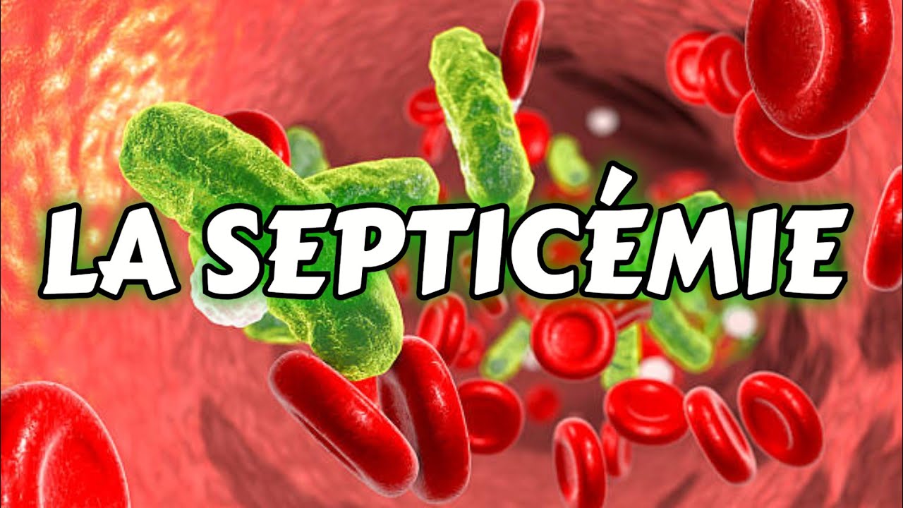 Comprendre la septicémie en une minute - YouTube