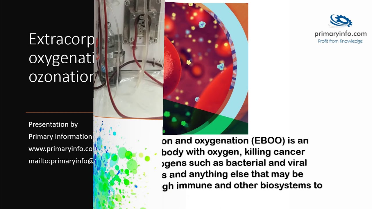 Extracorporeal blood oxygenation and ozonation - EBOO - YouTube