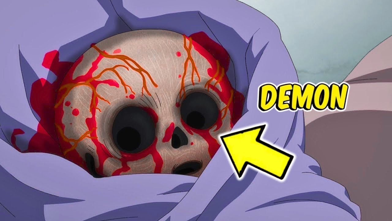 Boy Born Without Any Skin On His Body Is Sold To Demons For Money ...