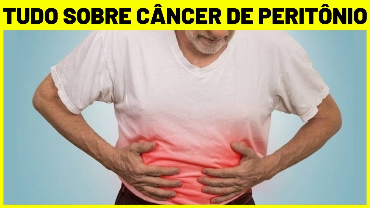 Cancer No Peritonio Feminino - RETOEDU