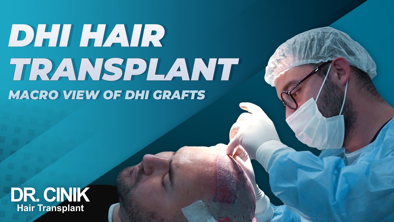 DHI HAIR TRANSPLANT | Dr.Cinik Hair Transplant Clinic - YouTube