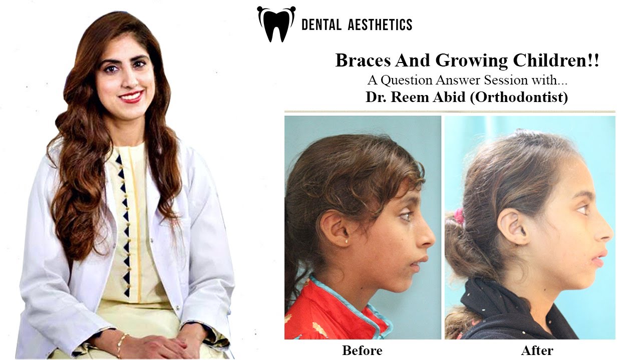 Children's Dental and Facial Symmetry | Braces | Growth Modification ...