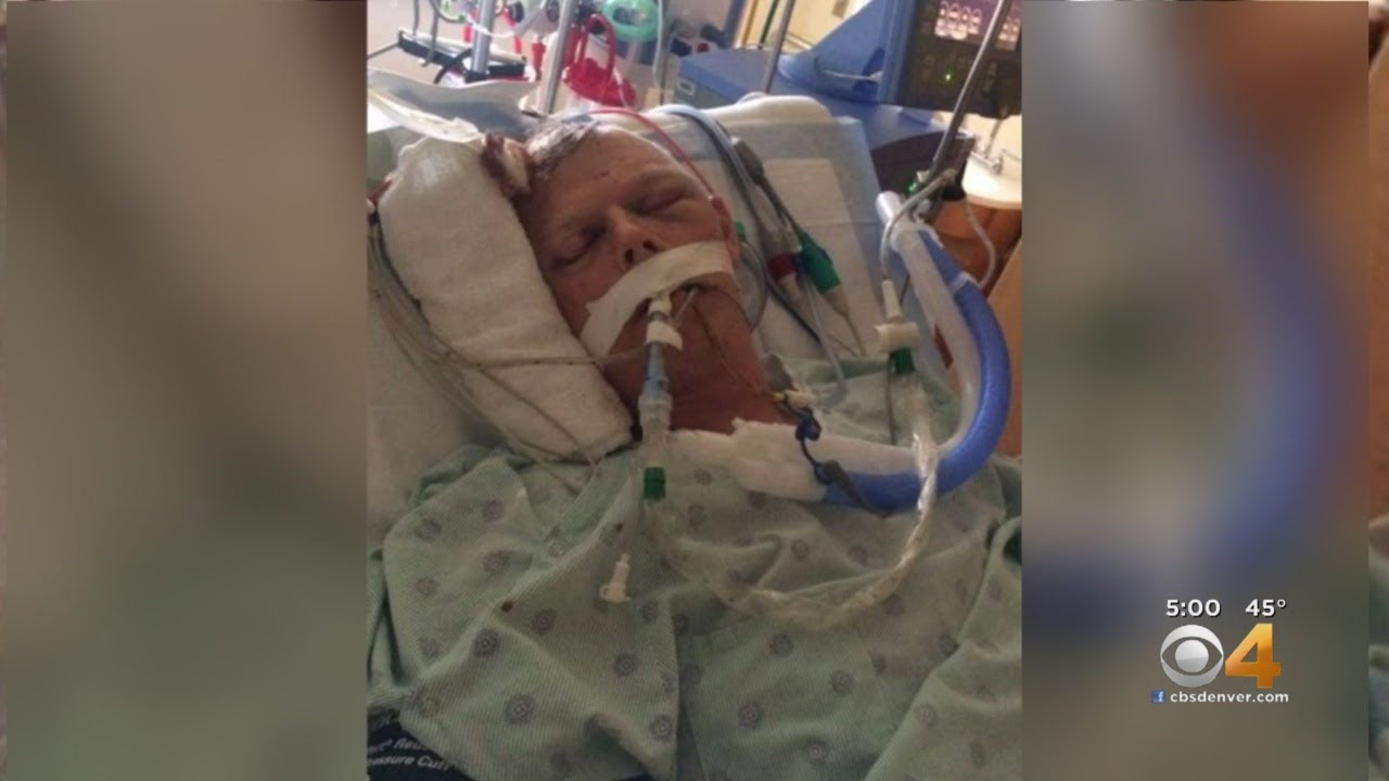 Man Suffers Traumatic Brain Injury After Crash On Electric Scooter ...