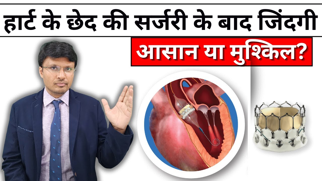 LIFE AFTER DEVICE CLOSURE congenital heart disease - YouTube